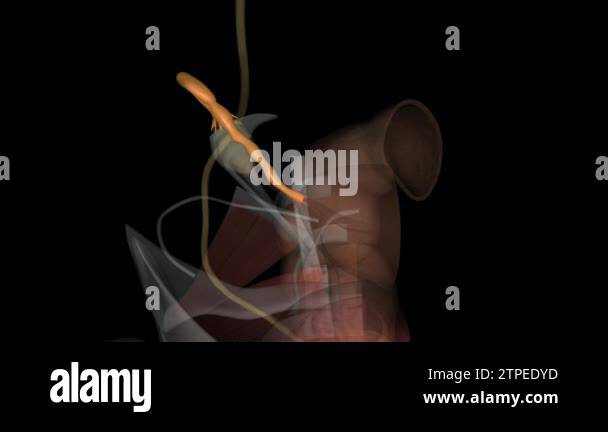The uterine tubes, also known as oviducts or fallopian tubes, are the ...