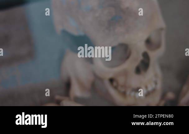 An exhibit of a human skull at museum. Real human skull of medieval ...