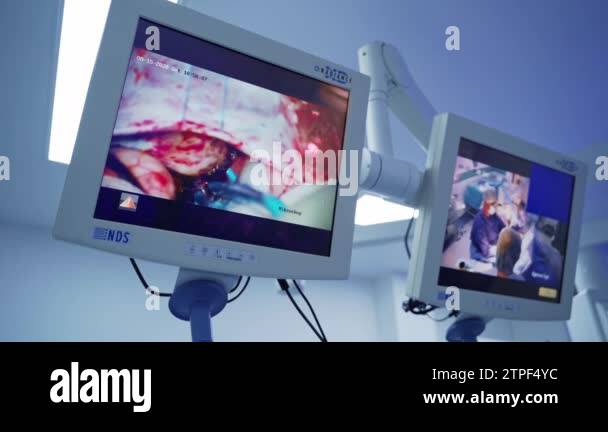 Medical monitors show operation. Internal organs with medical tool on ...