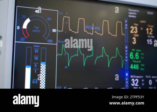 Artificial lung ventilation monitor in the intensive care unit ...