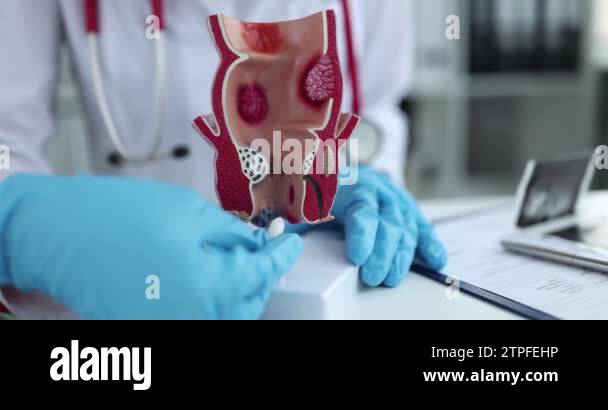 Proctologist doctor inserting rectal suppository into artificial model of human rectum closeup ...