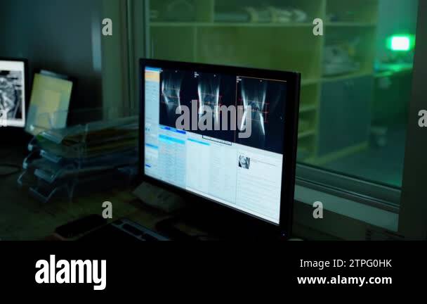 Radiologist x ray machine and screen Stock Videos & Footage - HD and 4K ...