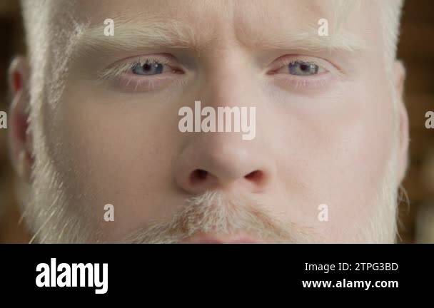 Male model with discolored hair pale skin. Concept of diversity ...