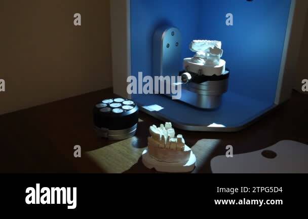 Scanning of the impression of the teeth for further printing on the ...