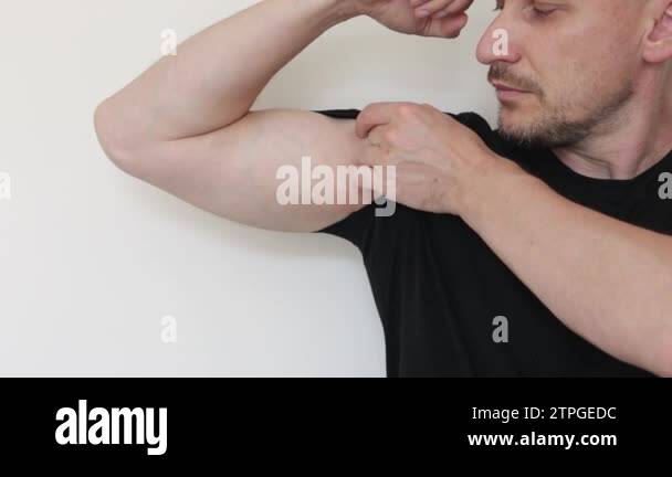 Armpit allergy. Young man shows and scratches irritation by hand on ...