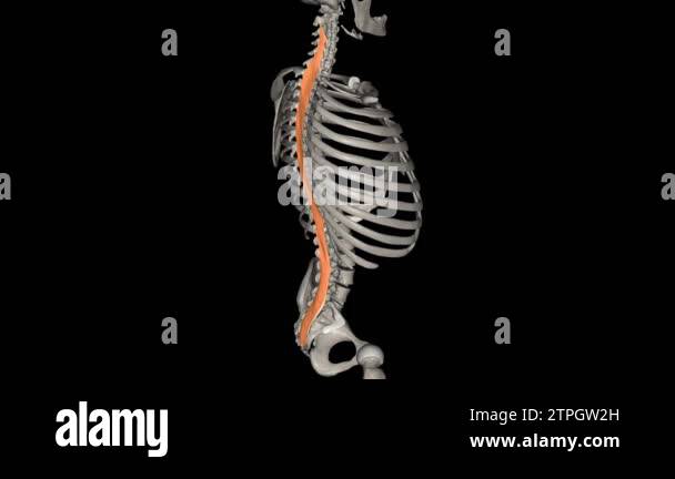 The multifidus muscle is an important stabilizer of the lumbar spine ...