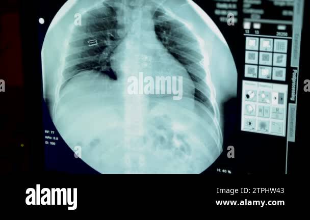 Full body xray Stock Videos & Footage - HD and 4K Video Clips - Alamy