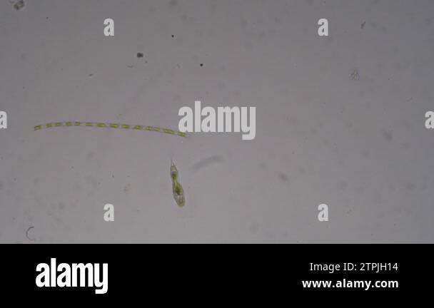 Baby of triops under a microscope. The microscopic world Stock Video ...