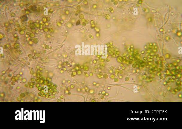 Microscopic view of organisms in the fusty water with rotten vegetation ...