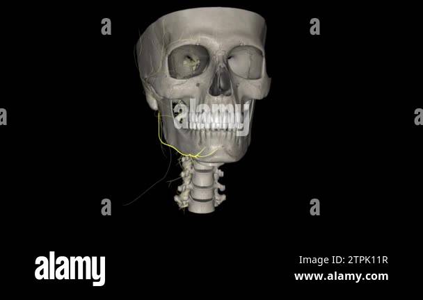 The marginal mandibular branch of the facial nerve arises from the ...