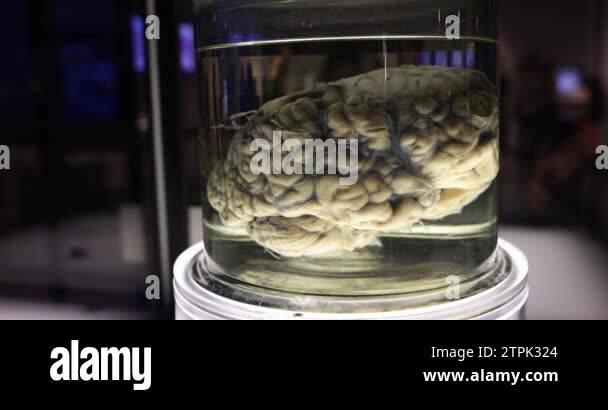Organs of anatomical museum and human brain. Human organs in jars with ...