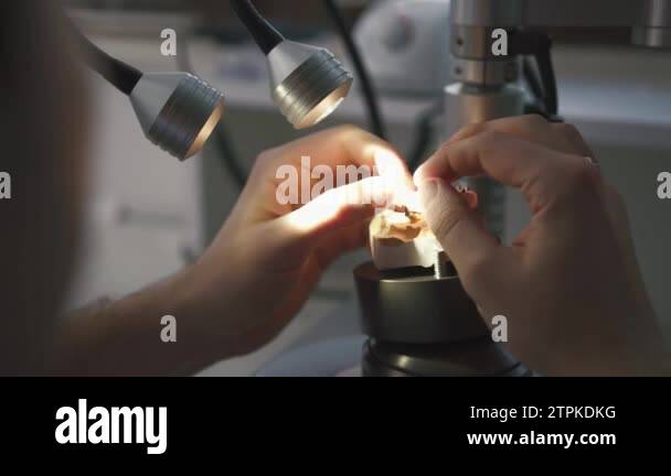 Prosthetic restoration Stock Videos & Footage - HD and 4K Video Clips ...