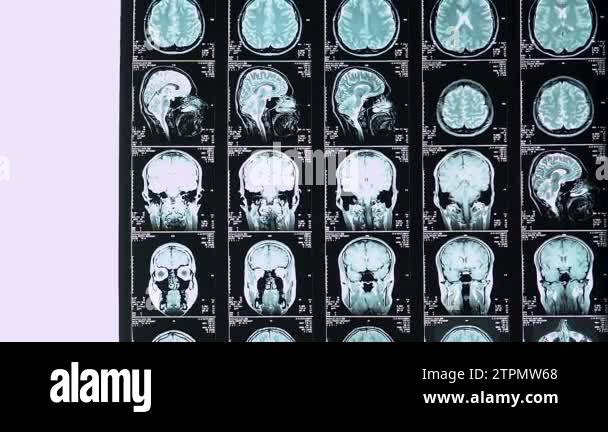 Young neurosurgeon calculating degree of patients brain concussion on ...