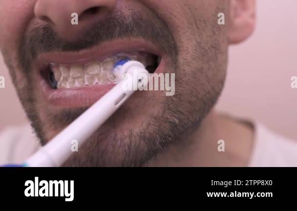 Man teeth mouth open Stock Videos & Footage - HD and 4K Video Clips - Alamy