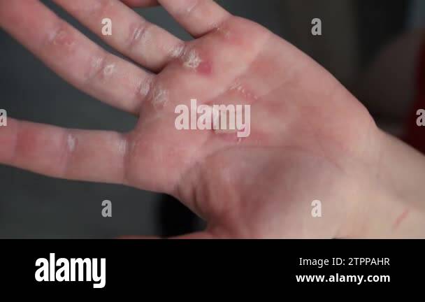 There's a callus on the palm of my hand from hard work. Street workout ...