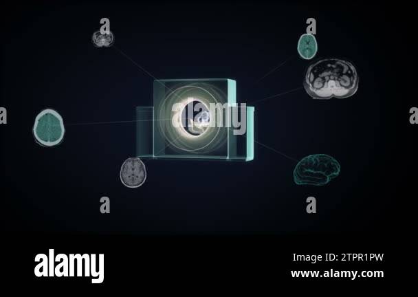 Ct scan symbol vector Stock Videos & Footage - HD and 4K Video Clips ...
