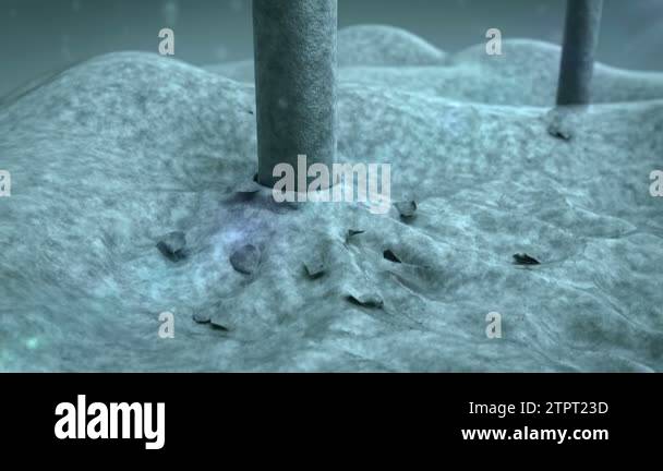 hair, dandruff, Skin under microscope, image of skin with hair, Camera ...