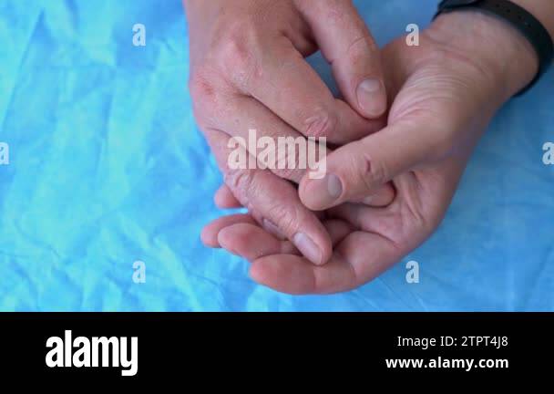 Skin desquamation Stock Videos & Footage - HD and 4K Video Clips - Alamy