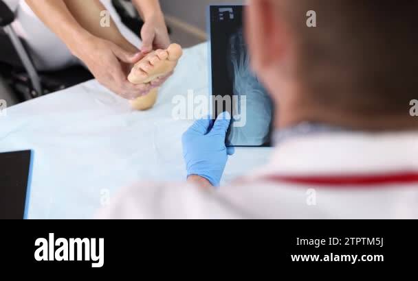 Surgeon examines X-ray of mortar of patient with pain syndrome. Foot ...