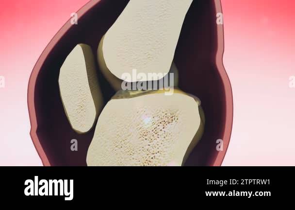 human knee, knee, 3d rendered knee illustration, pain illustration knee ...