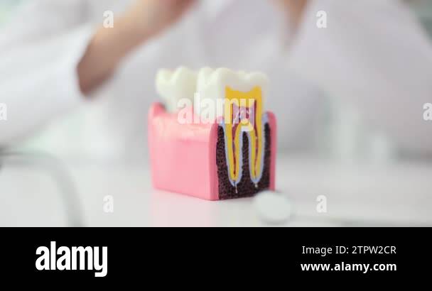 Doctor puts hands on sides of tooth artificial model making protection ...