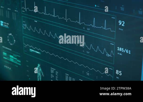 Modern ICU monitor in expensive clinic, patients vital signs monitored ...