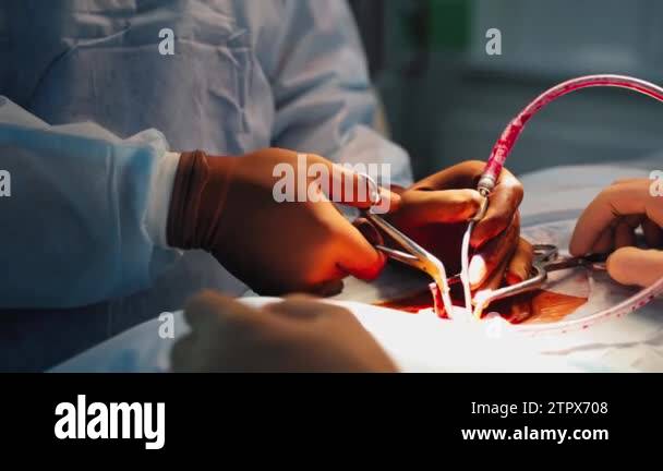 Neurosurgeons are performing operation in medical clinic. Hands of ...