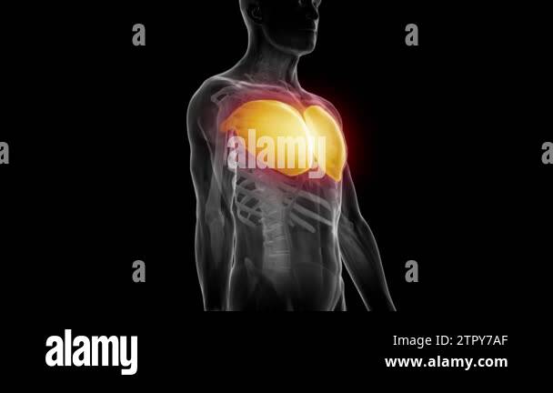 Pectoralis major pain Stock Videos & Footage - HD and 4K Video Clips ...