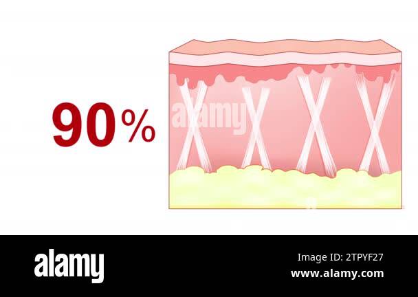 Aging process. Degradation of collagen fibers in the skin. Appearance ...