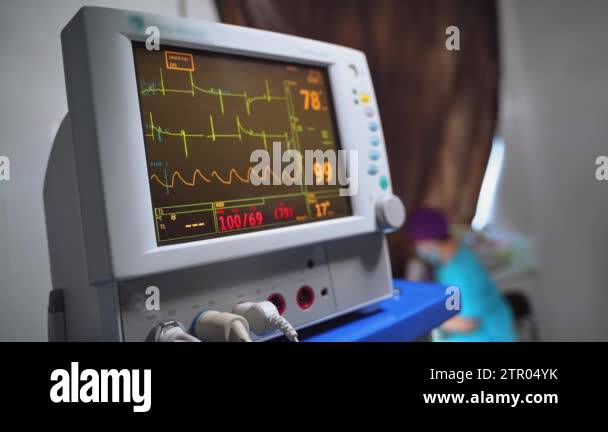 Heart rate monitor in surgical room. Vital signs of a patient on the ...