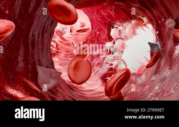 Hemostasis. Red blood cells and platelets in the blood vessel ...