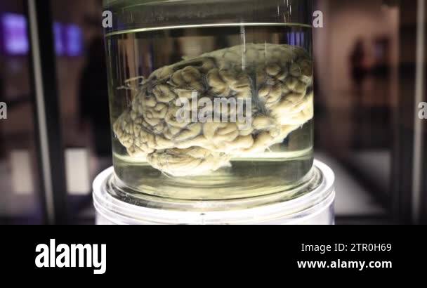 Human brains in formaldehyde jar lab. Preservation of organs and ...