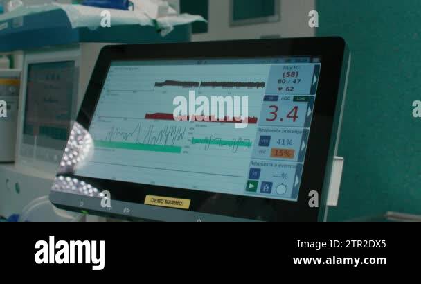 Close up on modern patient monitor show rhythm, SPO2, blood pressure ...