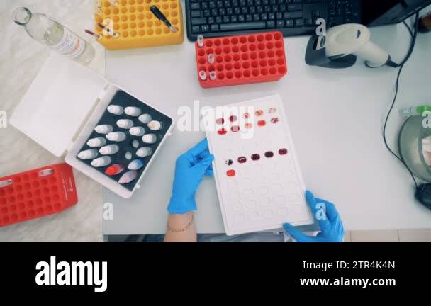 Blood samples on a special tray, top view. A nurse checks blood samples ...