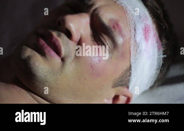 man with head injuries lying on the bed. bandaged head. bruise on his ...