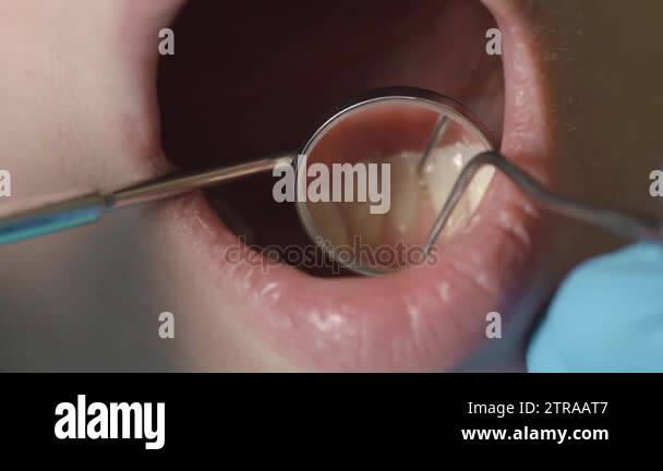 Examination Of The Mouth And Teeth. Close-up of patient young girl open ...