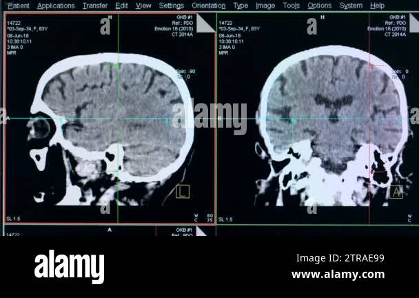 Head scan machine Stock Videos & Footage - HD and 4K Video Clips - Alamy