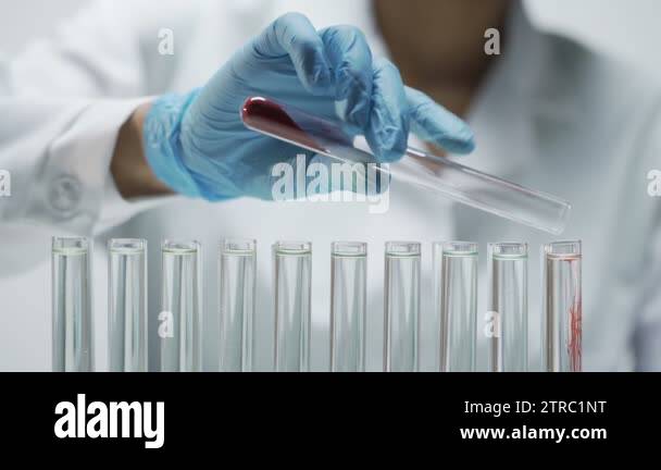 Lab material test tubes Stock Videos & Footage - HD and 4K Video Clips ...