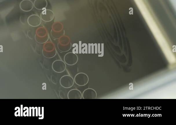 Freezing cells Stock Videos & Footage - HD and 4K Video Clips - Alamy