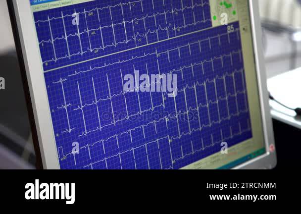 Ecg monitor screen Stock Videos & Footage - HD and 4K Video Clips - Alamy