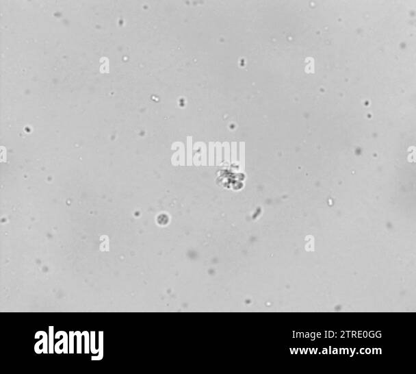 Photomicroscopy of activated sludge from the bacterial wastewater ...