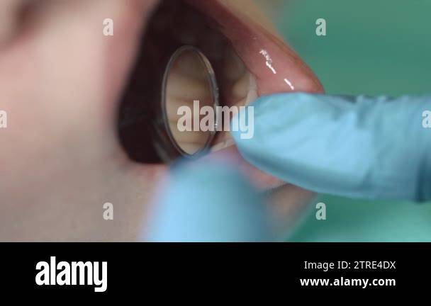 Examination Of The Mouth And Teeth. Close-up of patient young girl open ...
