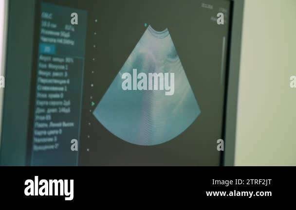 Close up ultrasound screen diagnostics Stock Videos & Footage - HD and ...