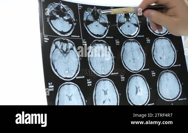 Mri of the human brain Stock Videos & Footage - HD and 4K Video Clips ...