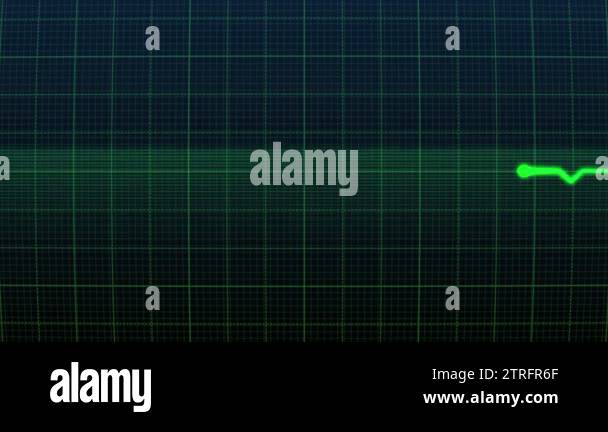 Heart rate Stock Videos & Footage - HD and 4K Video Clips - Alamy