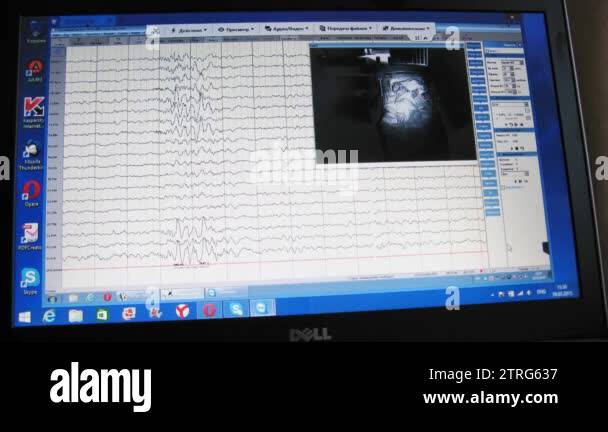 Neuroscope Stock Videos & Footage - HD and 4K Video Clips - Alamy