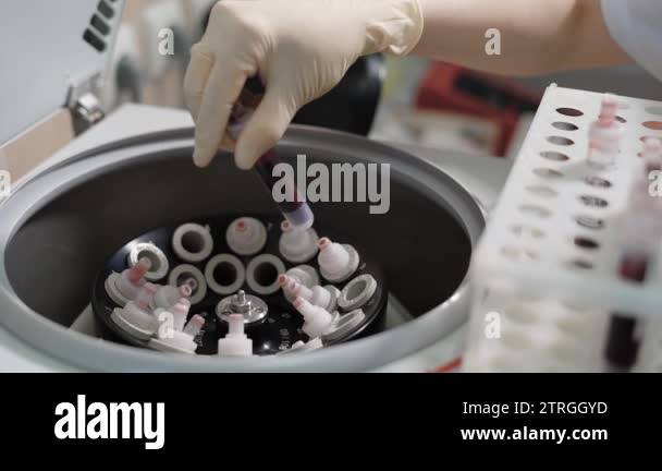 A centrifuge spins vials of liquid in a laboratory test. A medical ...