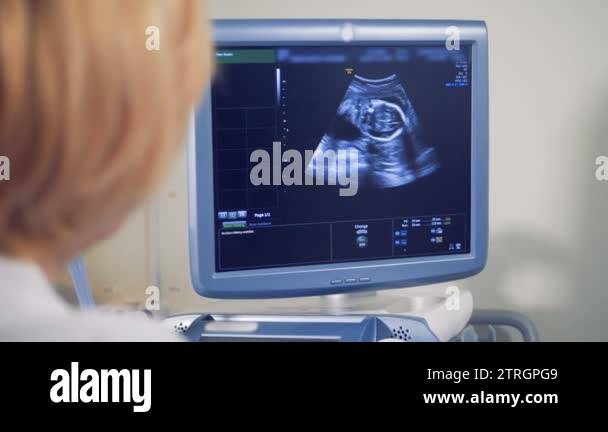 Ultrasound image scan fetus Stock Videos & Footage - HD and 4K Video ...