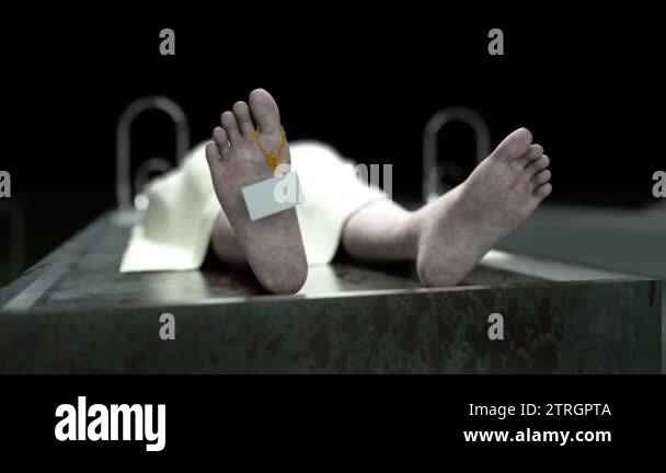 cadaver, dead male body in morgue on steel table. Corpse. Autopsy ...