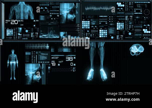 Blue futuristic patient monitor screen in perspective / Medical screen ...
